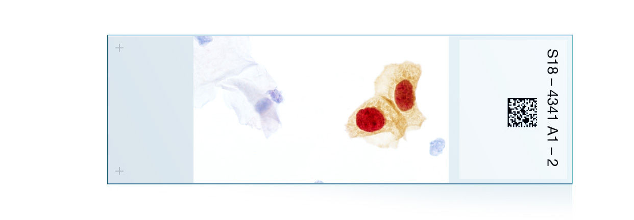Test CINtec® PLUS Cytology