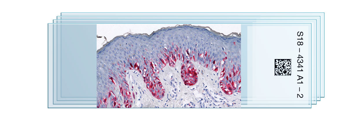 Dermatopathology IHC/ISH panel
