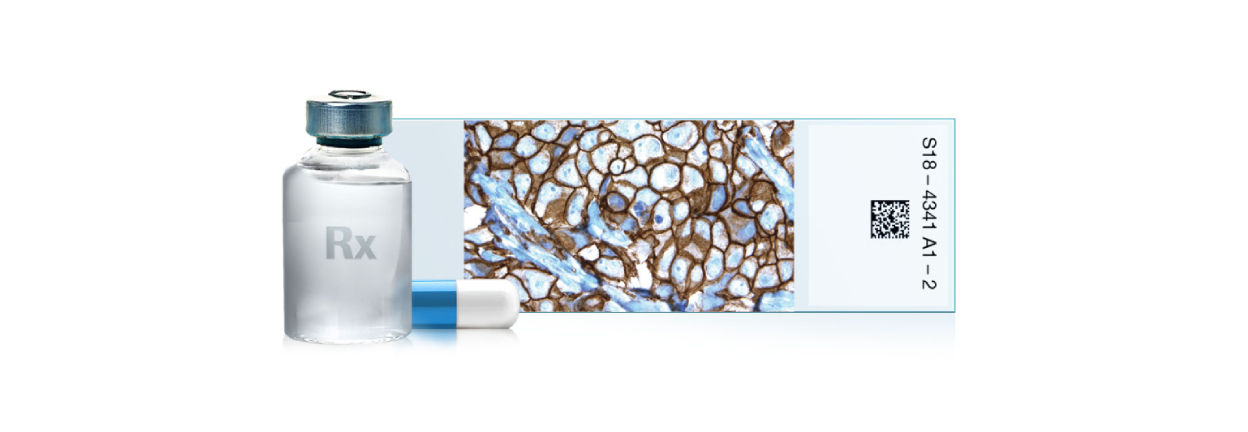 VENTANA® HER2 (4B5) Rabbit Monoclonal Primary Antibody RxDx, CE-IVD