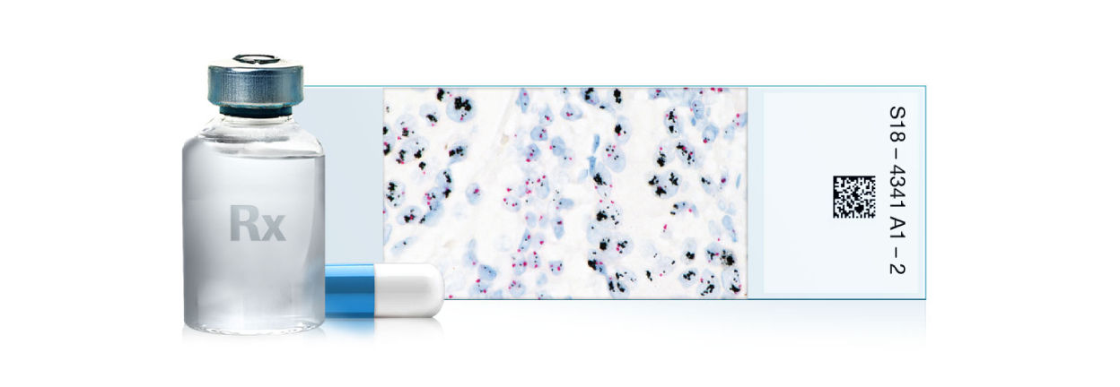 VENTANA® HER2 Dual ISH DNA Probe Cocktail, CE-IVD