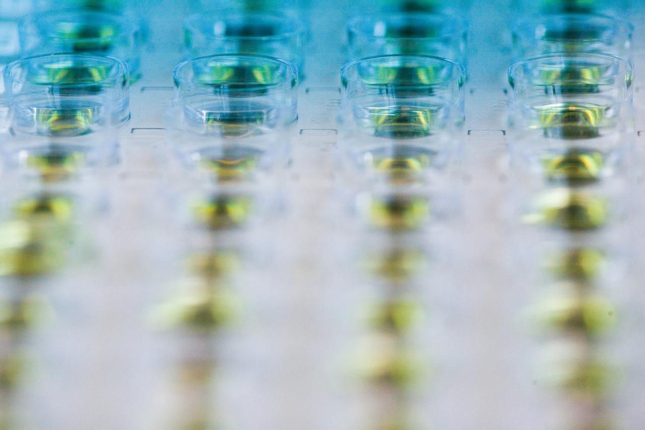 Transformation of the clinical laboratories of AZ Delta and Sint ...