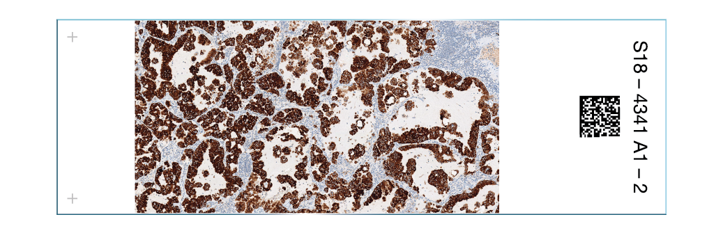 Ventana Antibody Catalog - Catalog Library