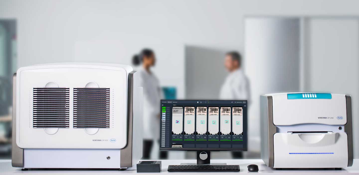 Slide Scanners To Digital With Tray Kenro KNSC201: Digital Film