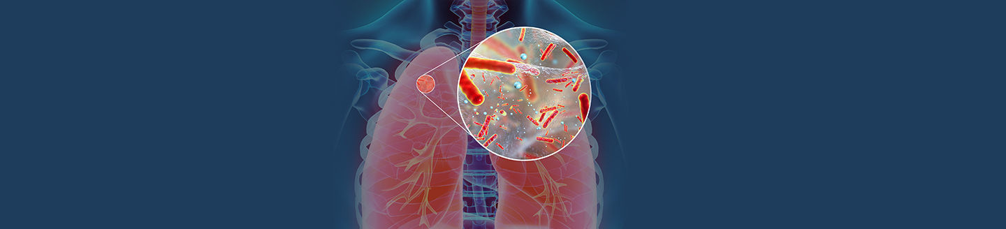 Union World Conference on Lung Health 2023