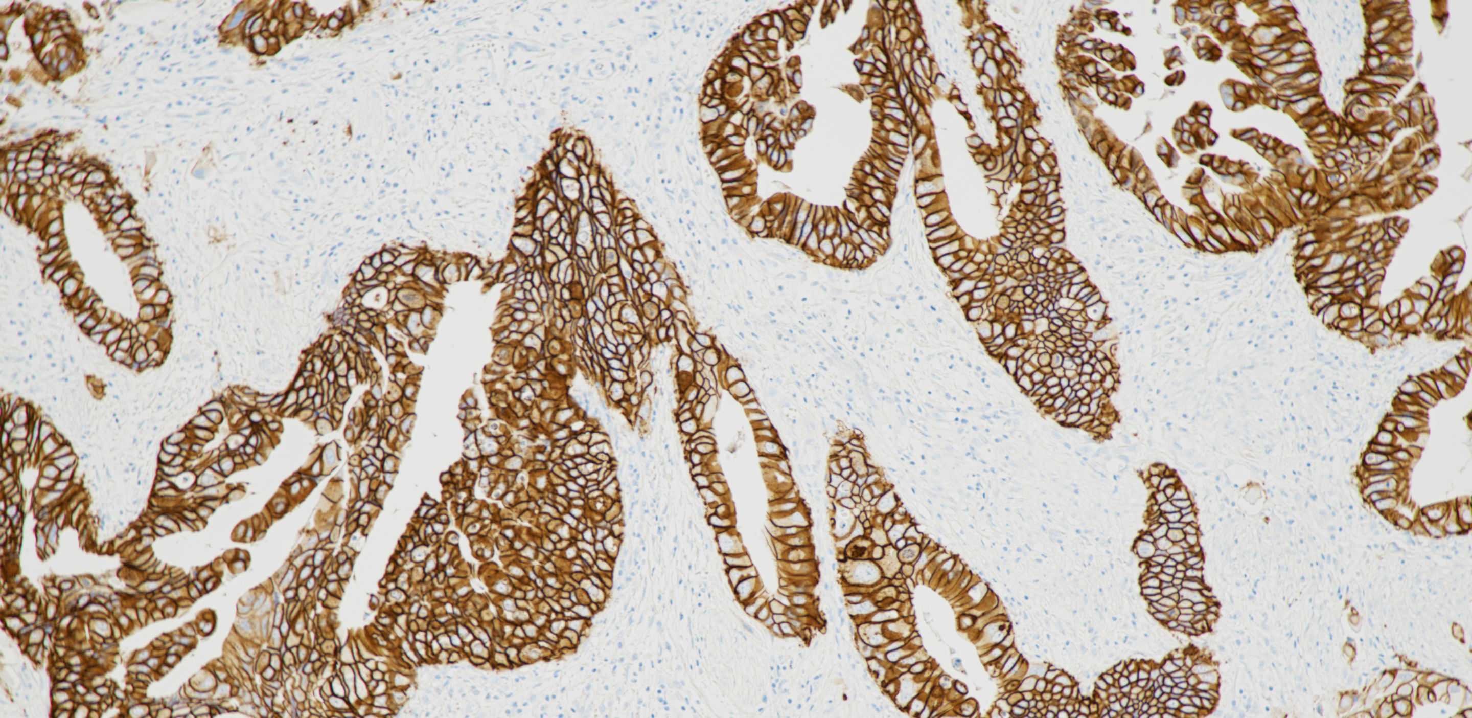 Roche receives FDA approval for first companion diagnostic to identify ...