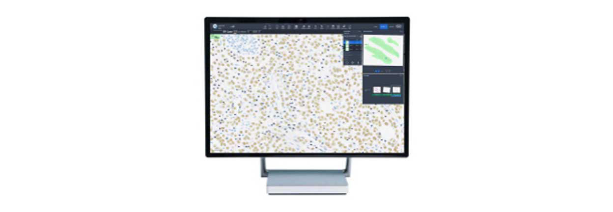 uPath ER (SP1) image analysis, Breast