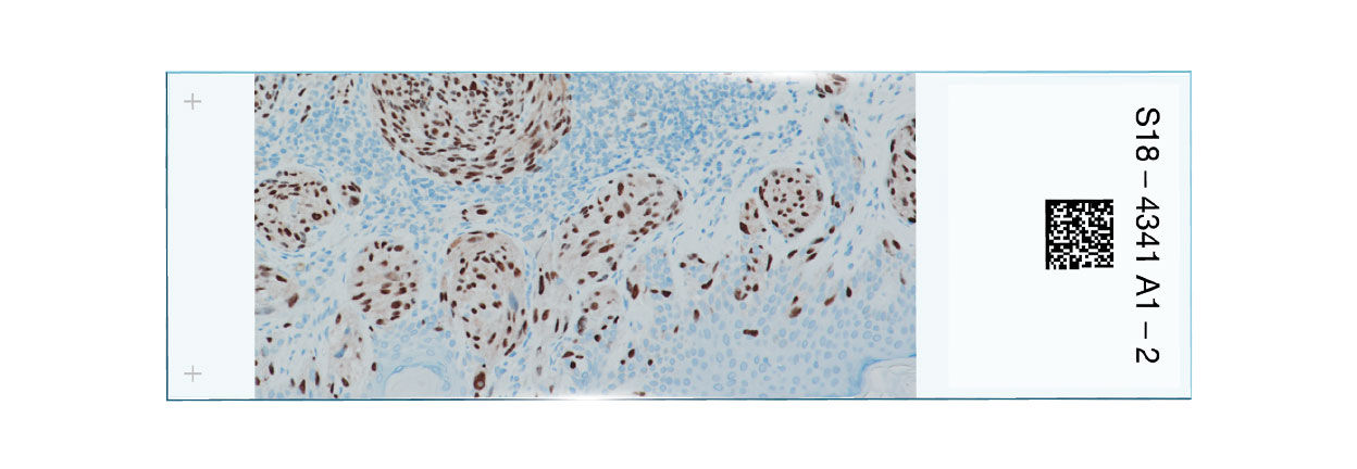 anti-PRAME (EPR20330) Rabbit Monoclonal Primary Antibody