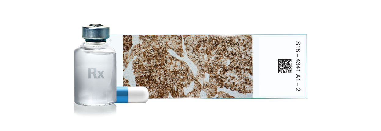 VENTANA® FOLR1 (FOLR1-2.1) RxDx Assay, Predictive IHC assay, FDA